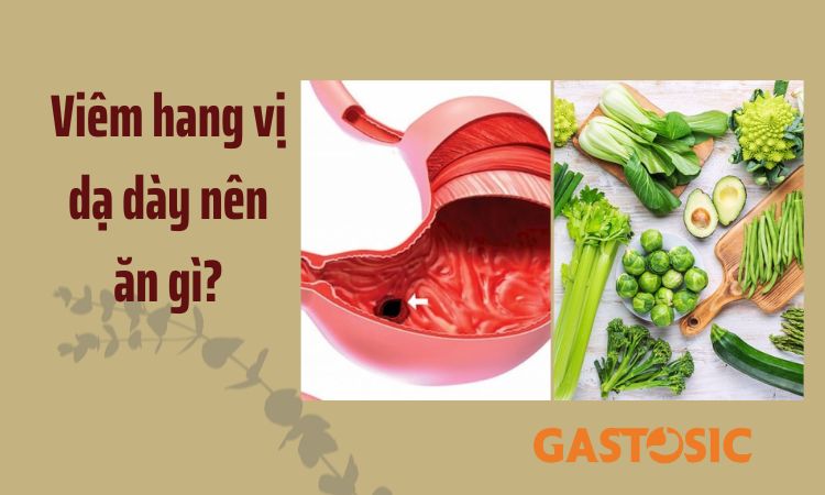 Bị viêm hang vị dạ dày nên ăn gì kiêng gì để mau khỏi?
